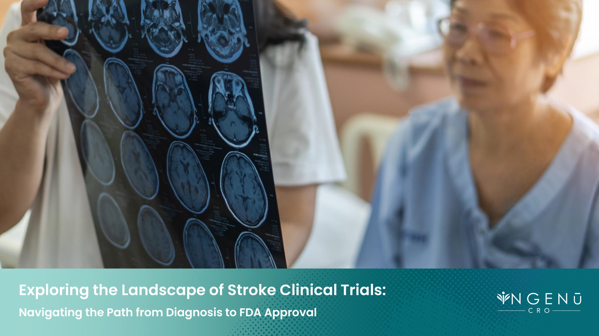 Stroke Clinical Trials CRO Stroke Clinical Trials CRO